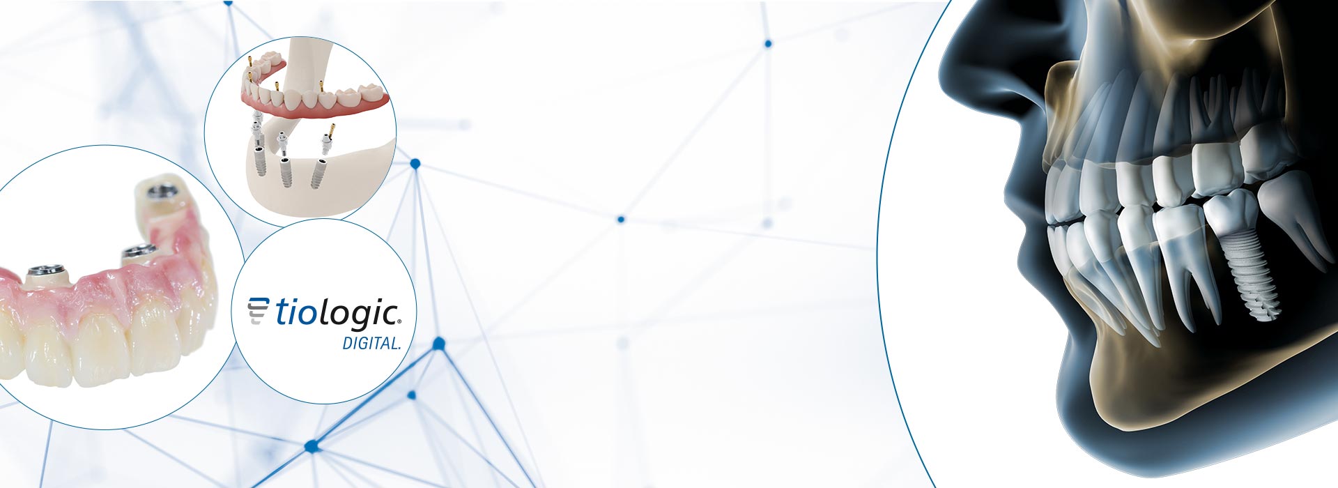 Digital Implantology