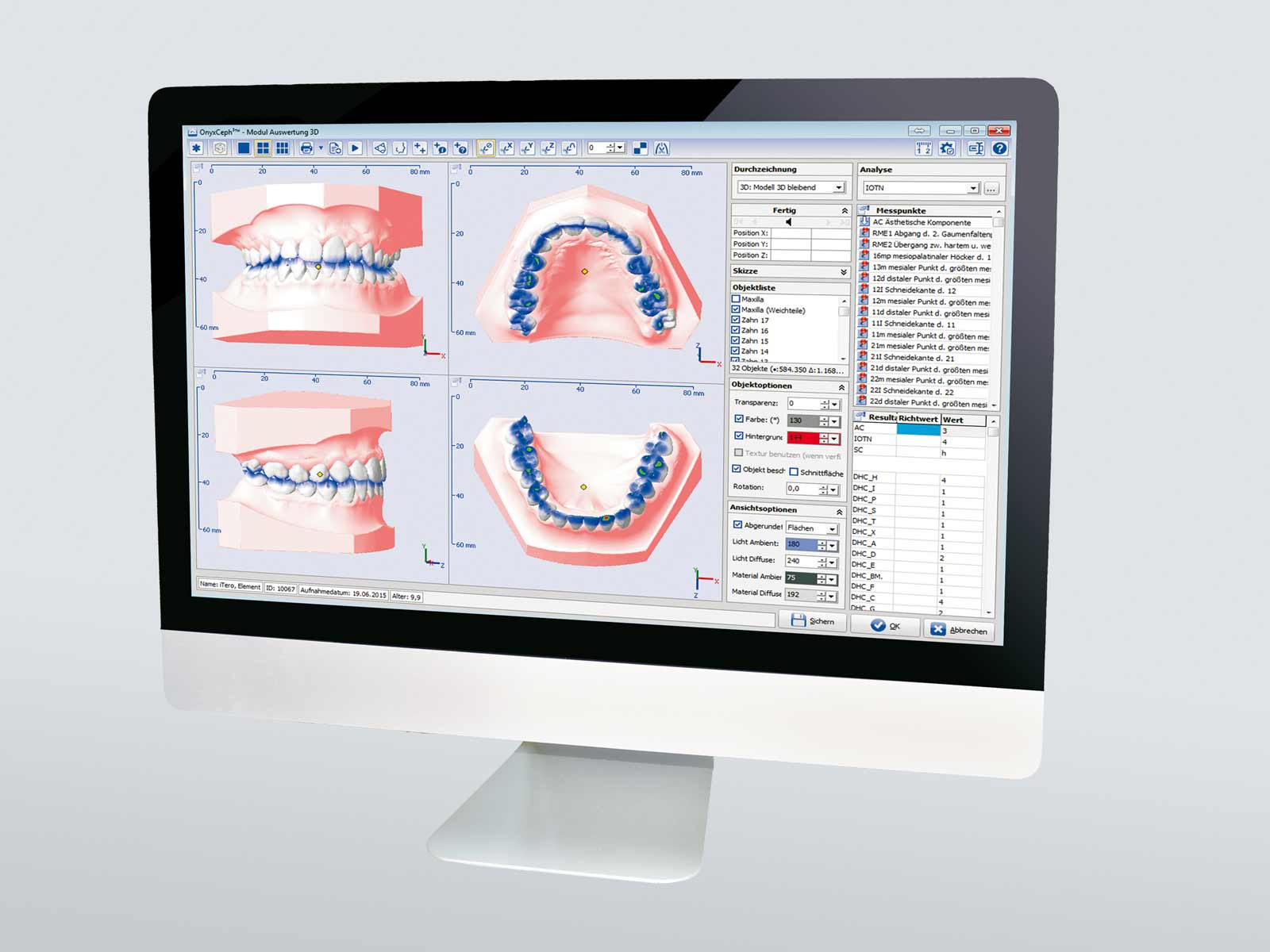 Software OnyxCeph3TM